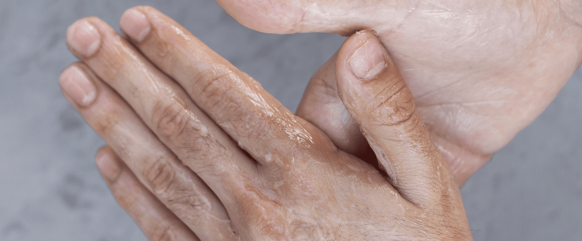 Understanding Scleroderma: Diagnosis and Testing Insights